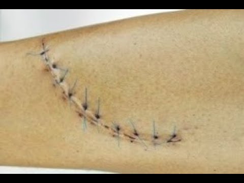 شرح GENERAL PATHOLOGY 19 repair 1 DR SAMEH GHAZY معتمد - منصة معارف