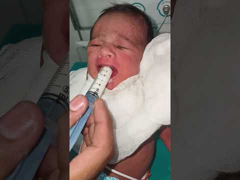 Baby 2nd day nicu admitted better condition #newbornbaby #positivebirth #baby #cute #newborn