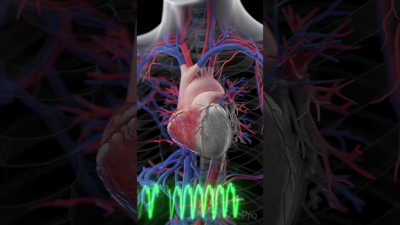Watch as a Heart Attack unfolds!  #anatomy #heartattack