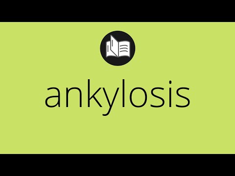 What ANKYLOSIS means • Meaning of ANKYLOSIS • ankylosis MEANING • ankylosis DEFINITION