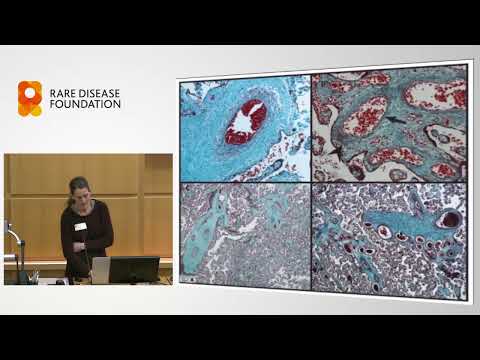 Dr. Anna Lehman Presentation at Rare Disease Day 2015