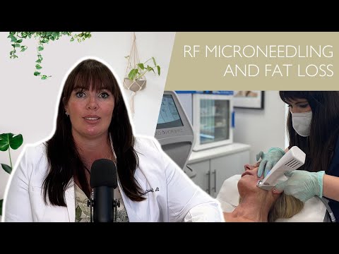Does RF Microneedling Cause Fat Loss? A Doctor's Thoughts