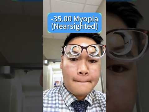 -35.00 D lense for Myopia or Nearsightedness #myopia #nearsighted #nearsightedness #glasses #elklook