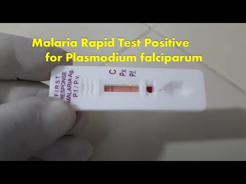 Malaria Rapid Test Positive Demonstration