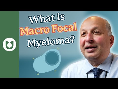 What is macro focal myeloma? #myeloma