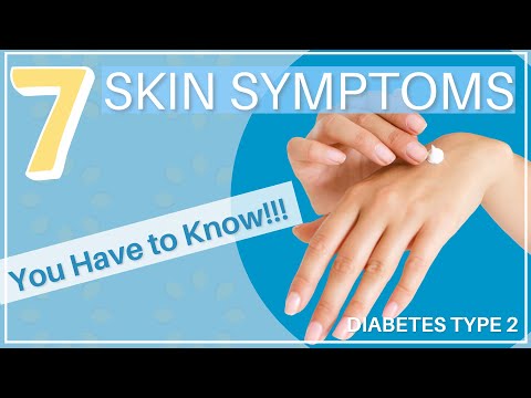 7⃣ Type 2 Diabetes Skin Symptoms that you have to know 🤔