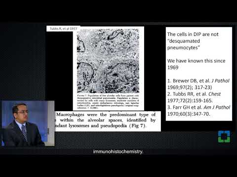 Pathology Insights: Smoking-Related Interstitial Fibrosis with Sanjay Mukhopadhyay, MD