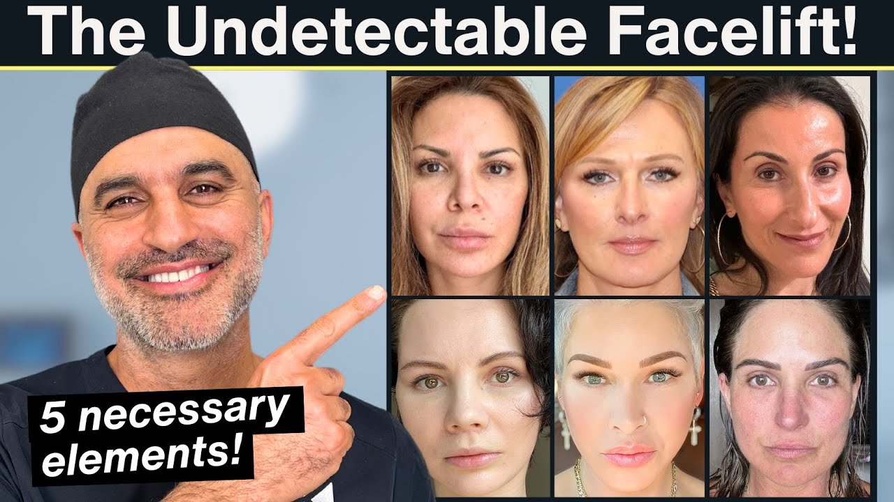 Plastic Surgeon reveals the 5 Necessary Ingredients to a Facelift that looks natural & undetectable