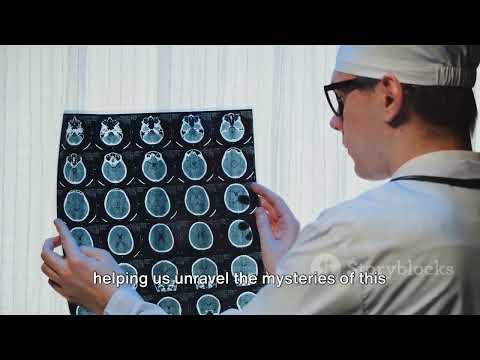 Post Covid-19 Complications Revealed with Advanced MRI Technology