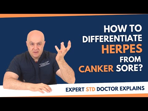 Herpes or Canker sore-learn how to tell the difference. Expert STD doctor (SlavaFuzayloff) explains
