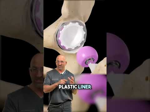 #1 Bone-on-Bone Hip Pain FIX - Hip Replacement ABC's #shorts