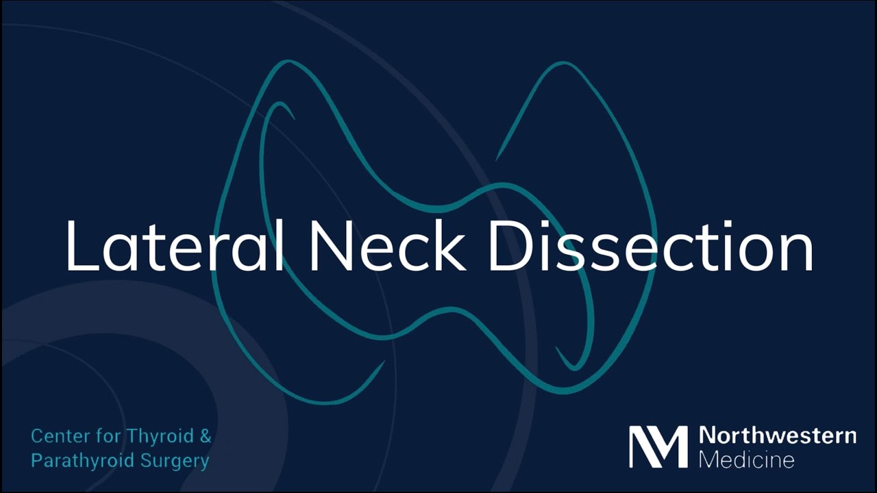 Lateral Neck Dissection