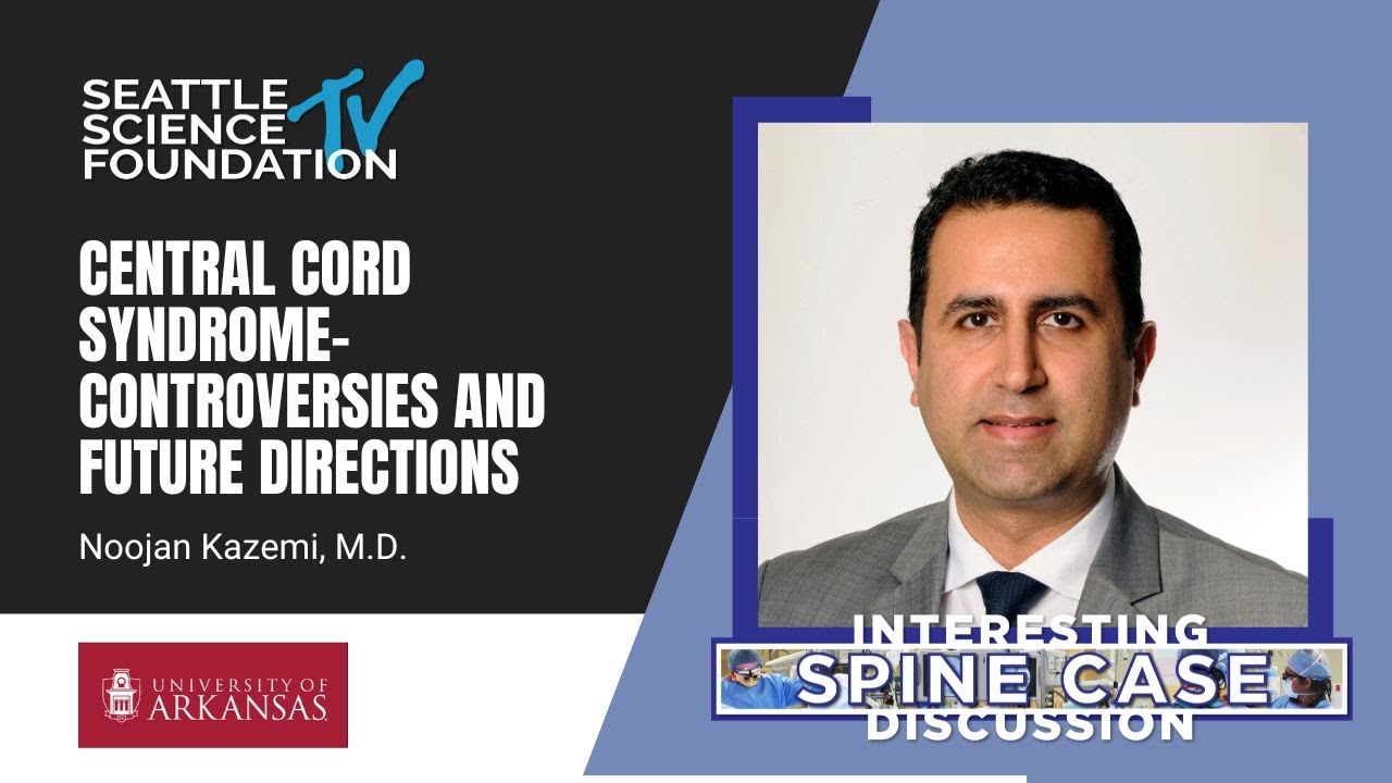 Central Cord Syndrome - Controversies and Future Directions – Noojan Kazemi, MD