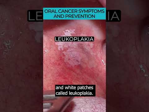 Recognizing early signs and preventing oral cancer 🎗️🚭