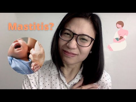 Mastitis: What is Mastitis? How to treat it? Should continue breastfeeding? | Dr. Kristine Alba Kiat