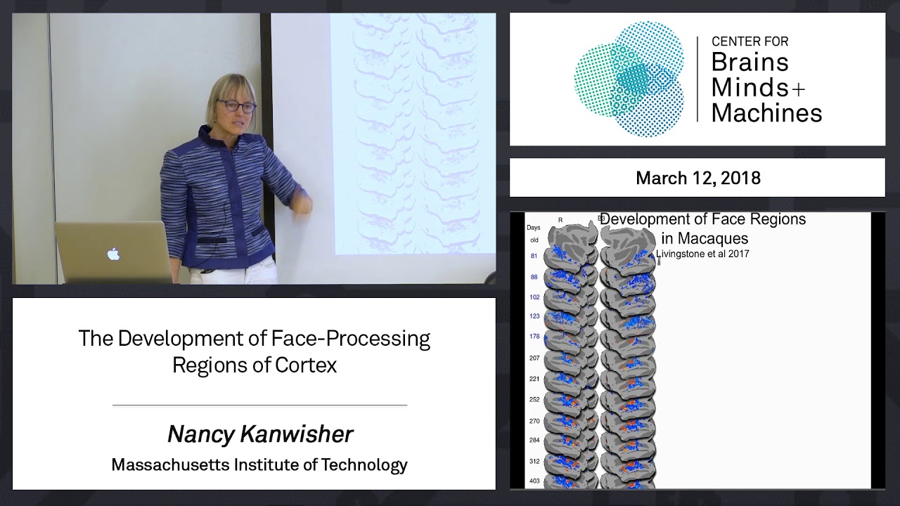 7.8 - The Development of Face Processing Regions of Cortex