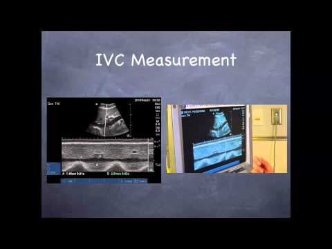Tutorial: Aorta & IVC