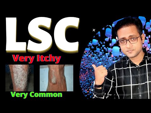 Skin disease caused by excessive itching : Lichen simplex chronicus | English