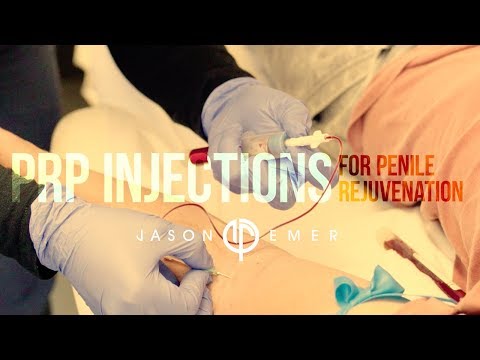 Platelet-Rich Plasma(PRP) P-SHOT Penile Rejuvenation |Erectile Dysfunction |PYRONIES |Dr. Jason Emer