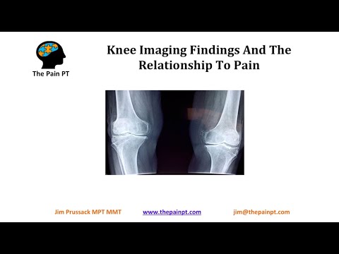 Knee Imaging Findings Are Not The Cause Of All Knee Pain- TMS- Dr. Sarno