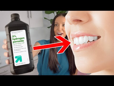 Can Hydrogen Peroxide ACTUALLY Whiten Your Teeth?