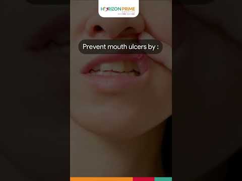 Reasons For Mouth Ulcers | Causes | Horizon Hospital | Thane | Mumbai