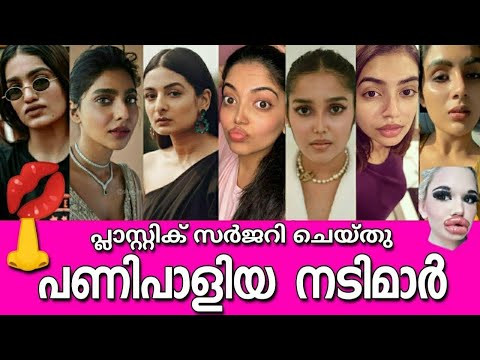 ????പ്ലാസ്റ്റിക് സർജറി ചെയ്ത് പണി പാളിയ മലയാള നടിമാർ????REAL PLASTIC SURGERY in Malayalam Film Industry????????