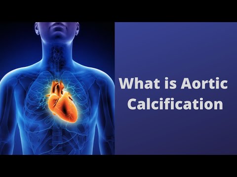 What is Aortic Calcification