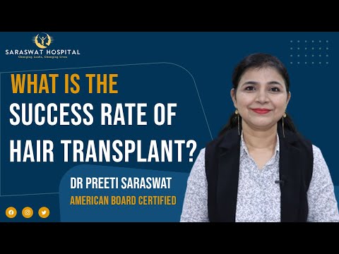What is The Success Rate of Hair Transplant? | Is Hair Transplant Worth It?