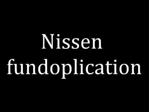 How to pronounce Nissen fundoplication