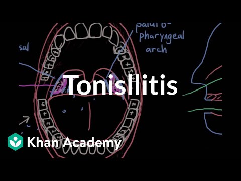 Tonsillitis | Respiratory system diseases | NCLEX-RN | Khan Academy