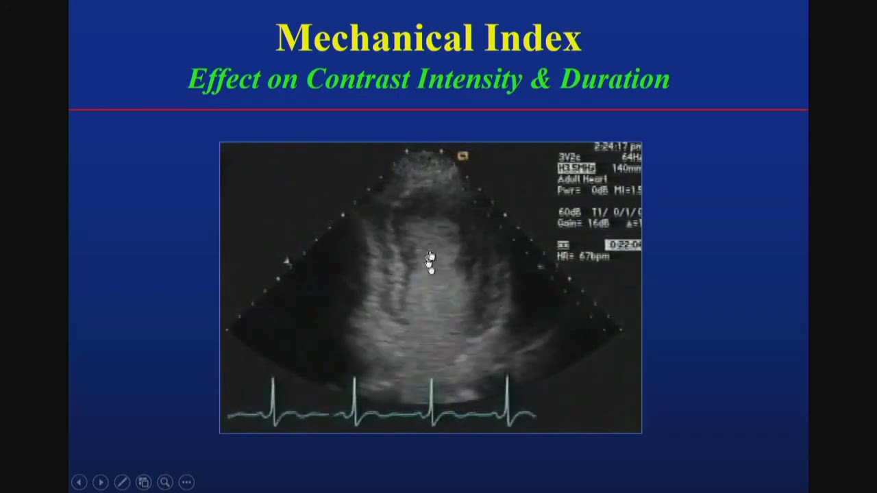 Principles of Contrast Echocardiography