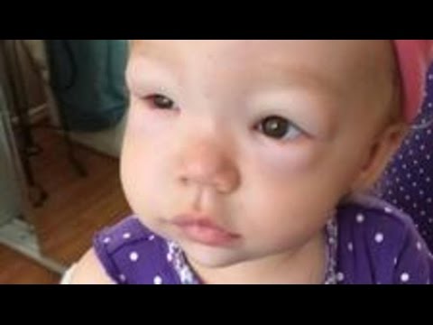 Ds’ Exclusive: The Little Blue Pill Could Save My Daughter; DEA Bans Dangerous Synthetic Drug; Pl…