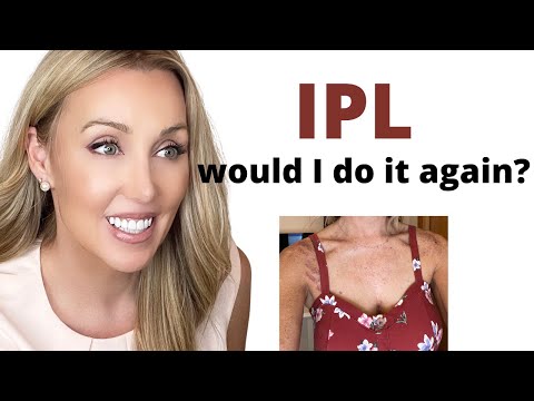 IPL WOULD I DO IT AGAIN? | Before and after pics for over 40 skin care