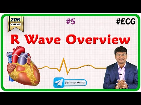 5. R Wave Overview - ECG assessment and ECG interpretation made easy