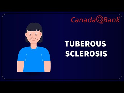 Tuberous Sclerosis: Symptoms, Genetics & Diagnosis | High-Yield Review | CanadaQBank