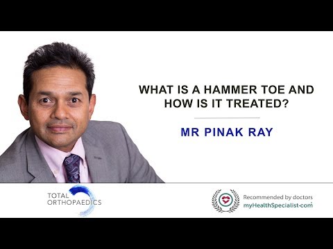 What is a hammer toe and how is it treated?