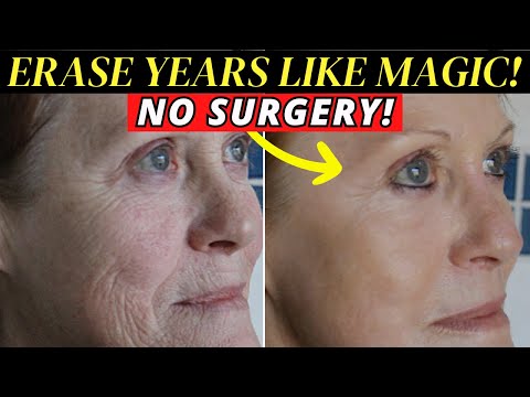 The INCREDIBLE benefits of chemical peels for anti-aging!