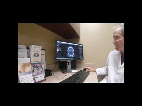 Review of a CT Scan with Dr. Simons