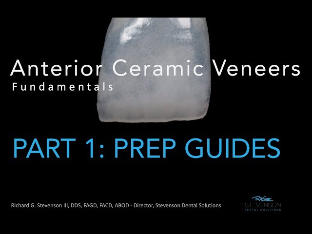 A Comprehensive Guide to Anterior Ceramic Veneers: Preparation Guides ...