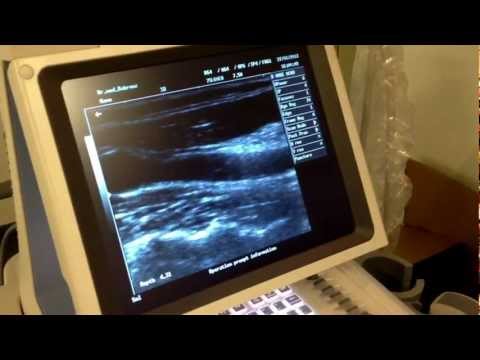 Mindray Ultrasound Machines - Latest Price, Dealers & Retailers in India