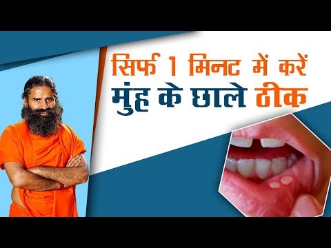 सिर्फ 1 मिनट में करें मुंह के छाले ठीक | Swami Ramdev