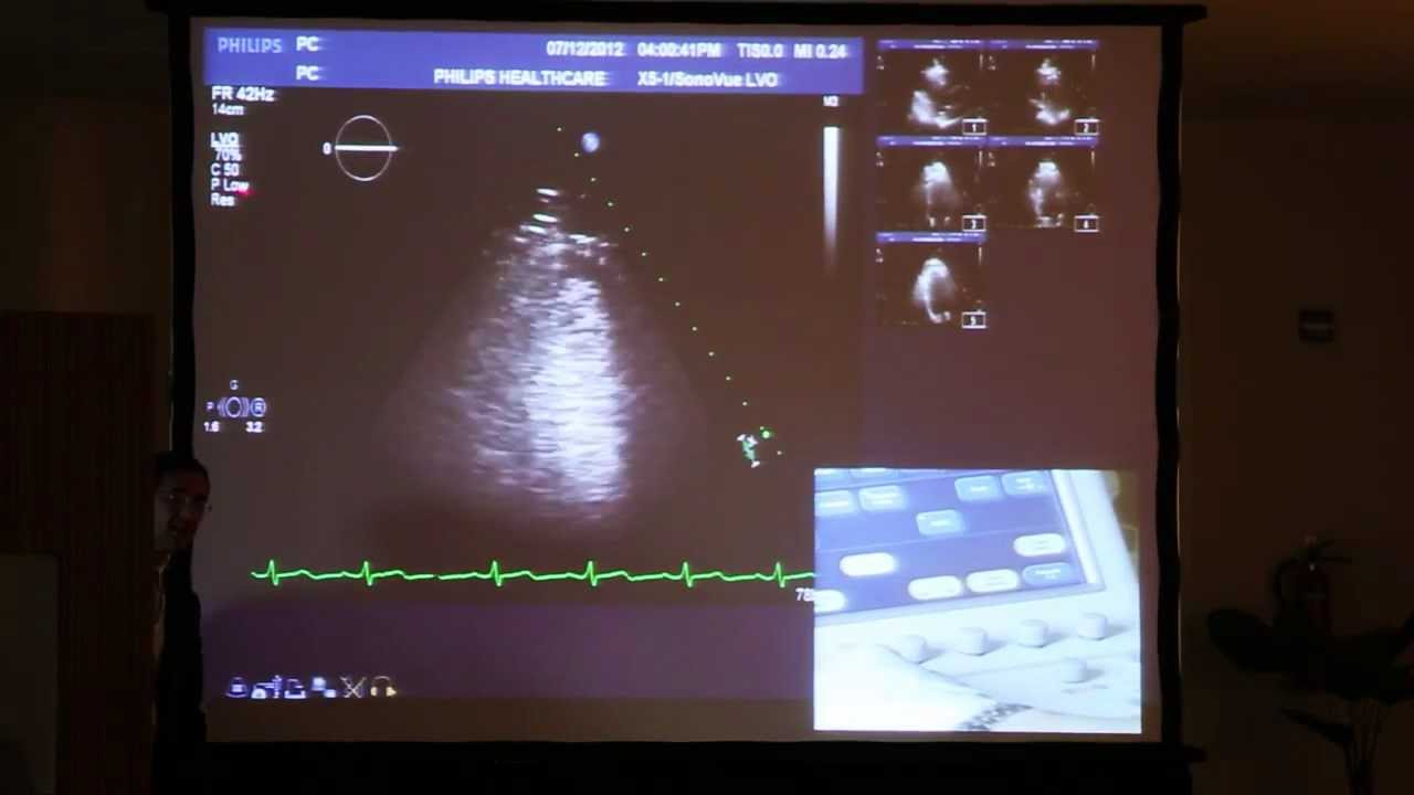 Use of Contrast Echocardiography in Clinical Practice and Research  by Dr Jonathan Lindner