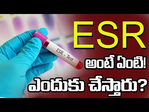 ESR టెస్ట్ అంటే ఏంటి? ఎందుకు చేస్తారు ?| What is ESR Test | Health Tips