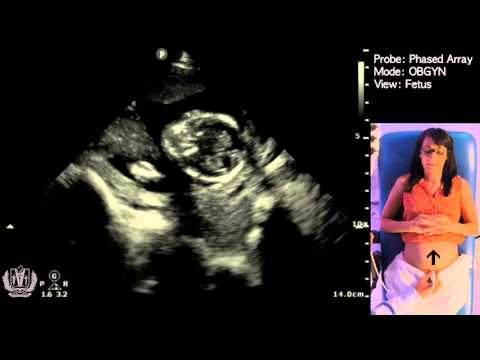 Obstetric Ultrasound Basics with Fetal Heart Rate Calculation - Made Simple