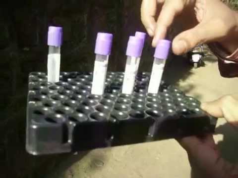 Test Tube Racks - Tube Storage Rack Latest Price, Manufacturers & Suppliers