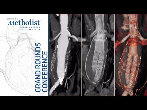 Secrets to Success in Academic Surgery (Ronald L. Dalman, MD) June 24, 2021