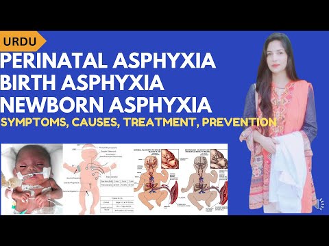 Perinatal asphyxia, Birth asphyxia, Newborn asphyxia, Neonatal resuscitation Urdu Hindi