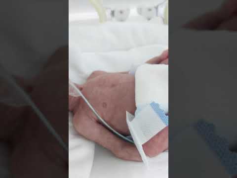 Case 269 mottled skin DD ( curtis marmarota, sepsis, hypothermia, hypotension, hypoperfusion,)
