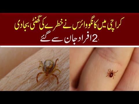 Congo virus raises alarm in Karachi, 2 people die | Nawa-i-Waqt